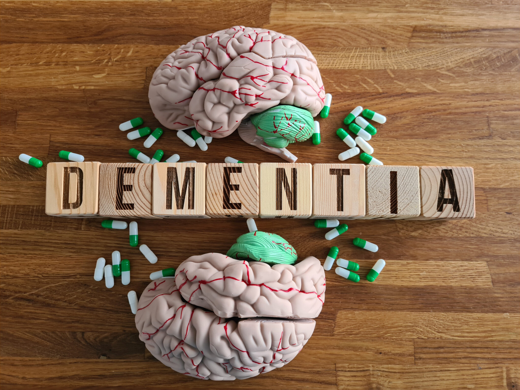 Understanding the Difference between Dementia & Alzheimer’s